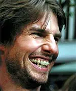 Midline Discrepancy – How It Affects Your Appearance | Redwood Shores ...